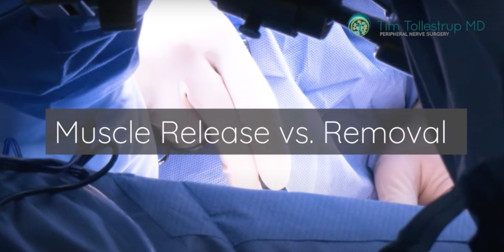 Piriformis Muscle Release vs. Piriformis Muscle Removal - Tim Tollestrup MD